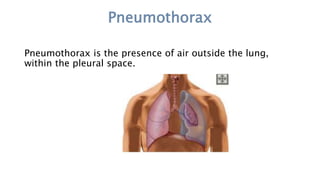 Pneumothorax | PPTX