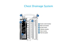 Pneumothorax | PPTX