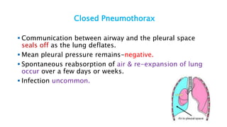 Pneumothorax | PPTX