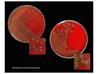 Pneumococci | PPT