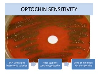 Pneumococci | PPTX | Lung and Respiratory Health | Diseases and Conditions