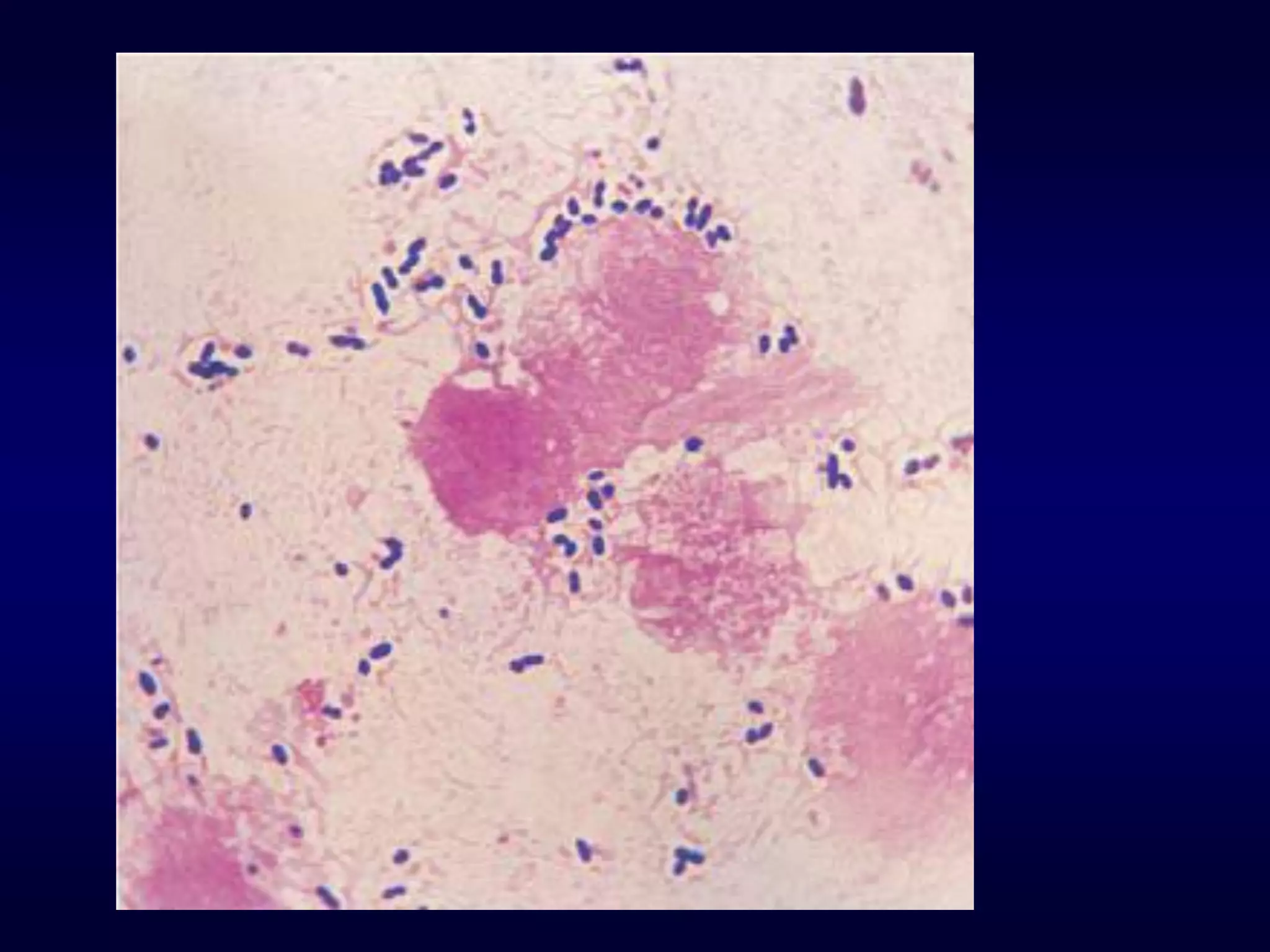 Pneumococci ppt mahadi | PDF
