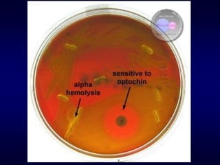 Pneumococci ppt mahadi | PDF | Lung and Respiratory Health | Diseases ...