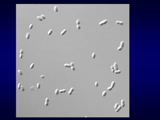 Pneumococci ppt mahadi | PDF | Lung and Respiratory Health | Diseases ...