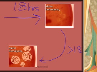 Pneumococcus | PPT