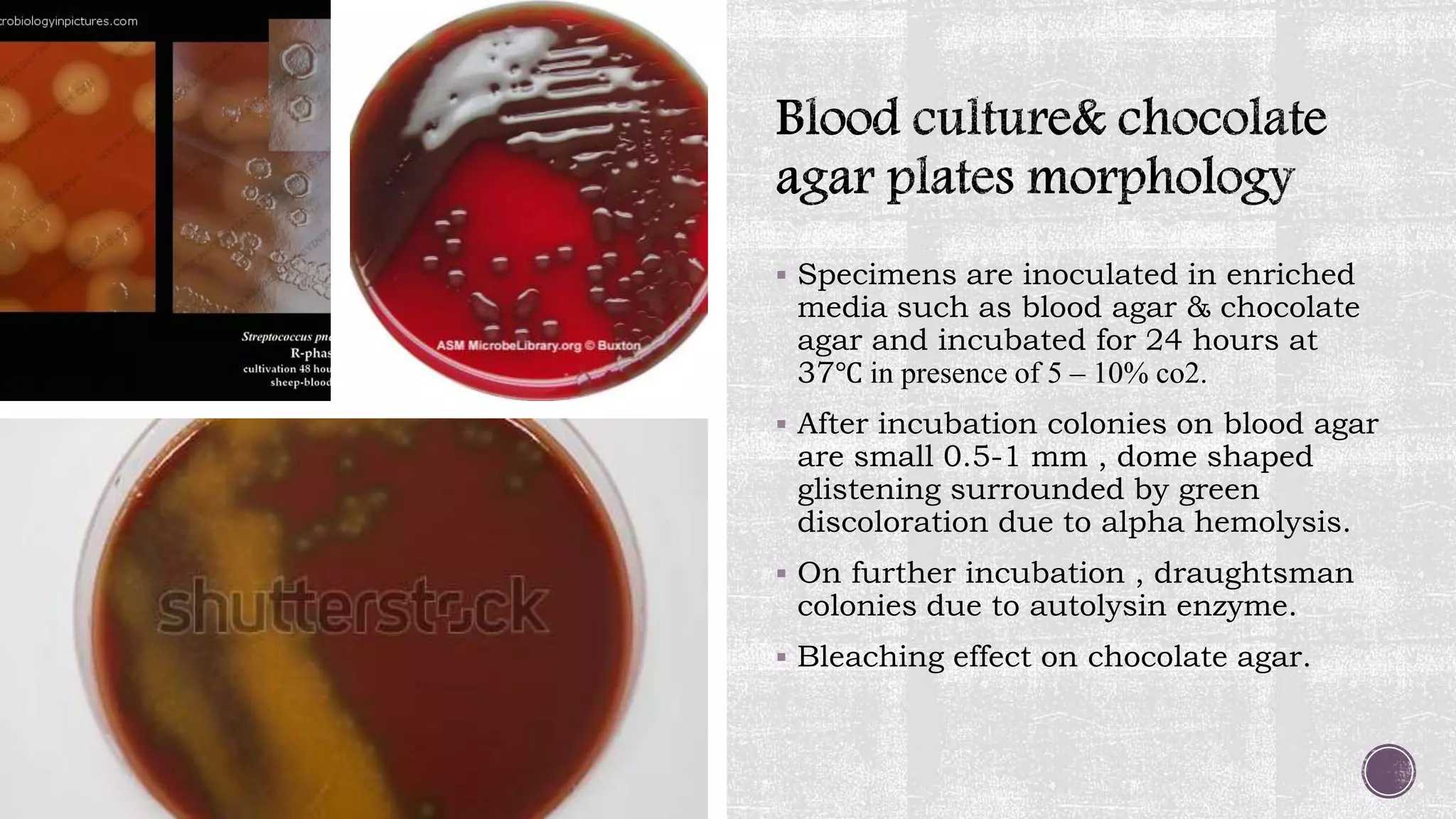 Pneumococcus | PPTX