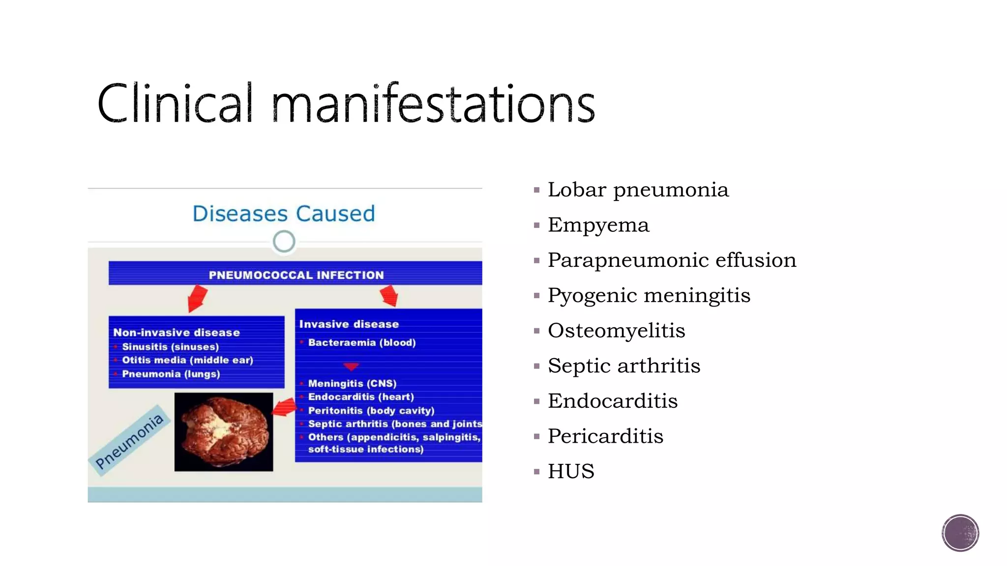 Pneumococcus | PPTX