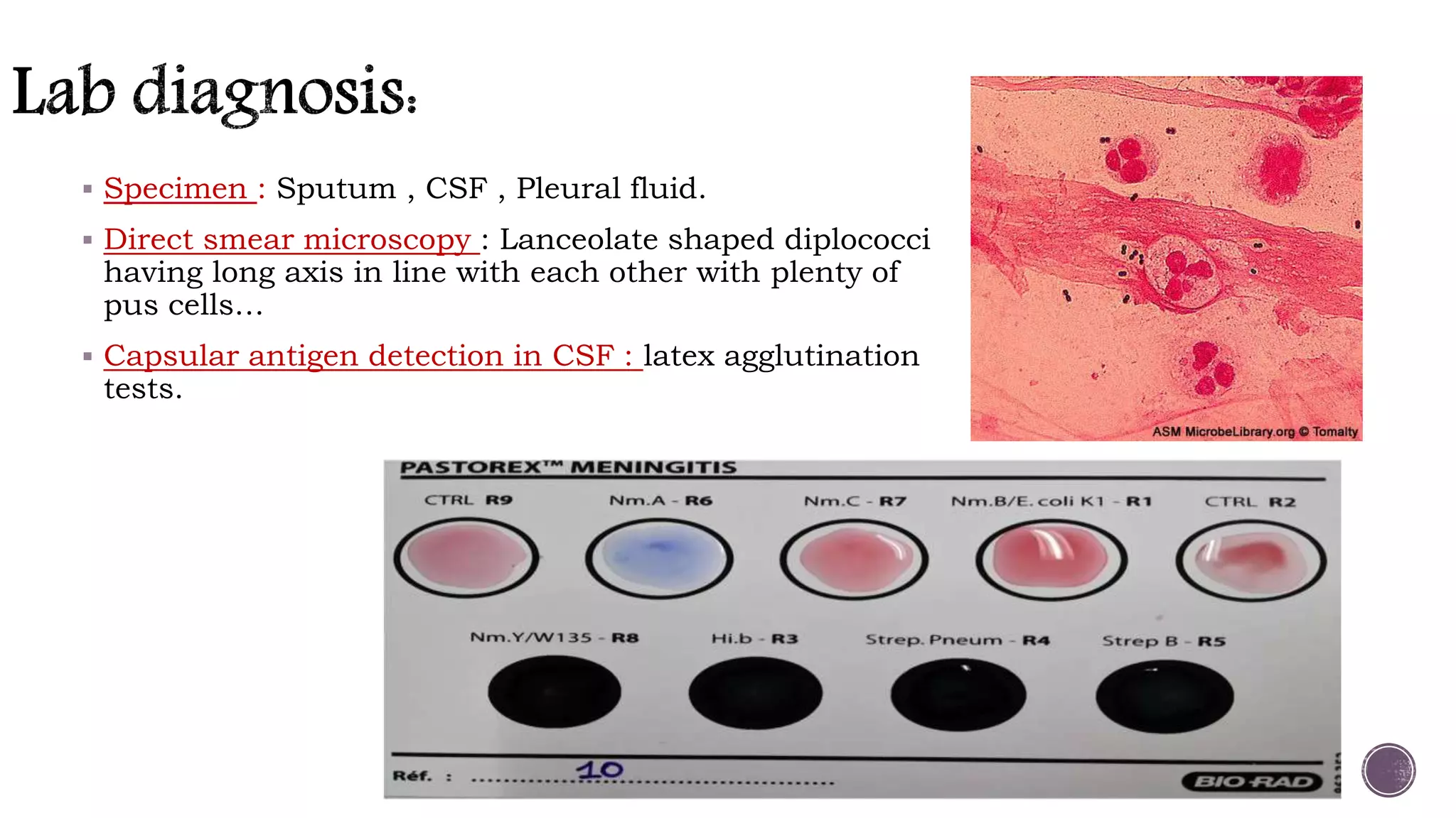 Pneumococcus | PPTX