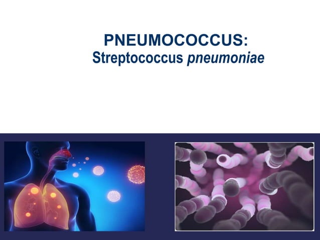 Pneumococcus | PPT