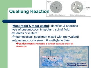 Pneumococcus.ppt