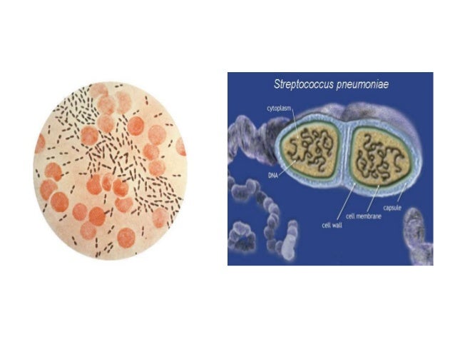 Pneumococcus (Morphology & Pathogenesis)