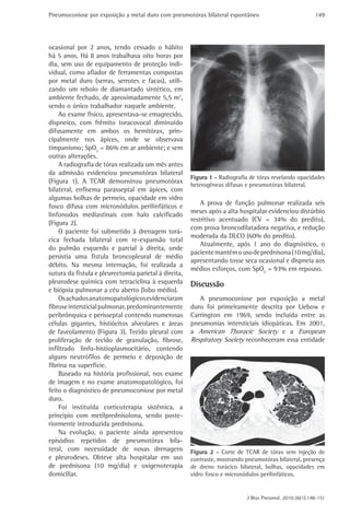 Pneumoconiose por exposição a metal duro | PDF