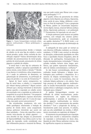 Pneumoconiose por exposição a metal duro | PDF