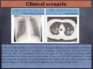 Pneumoconiosis | PDF