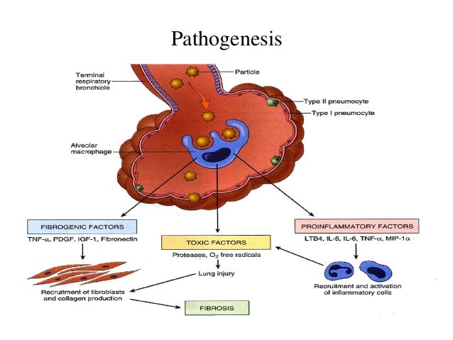 Pneumoconiosis