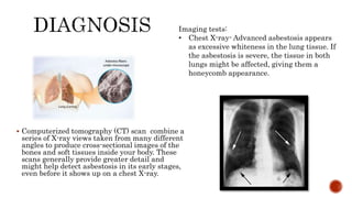 Pneumoconiosis.pptx