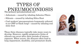 Pneumoconiosis.pptx