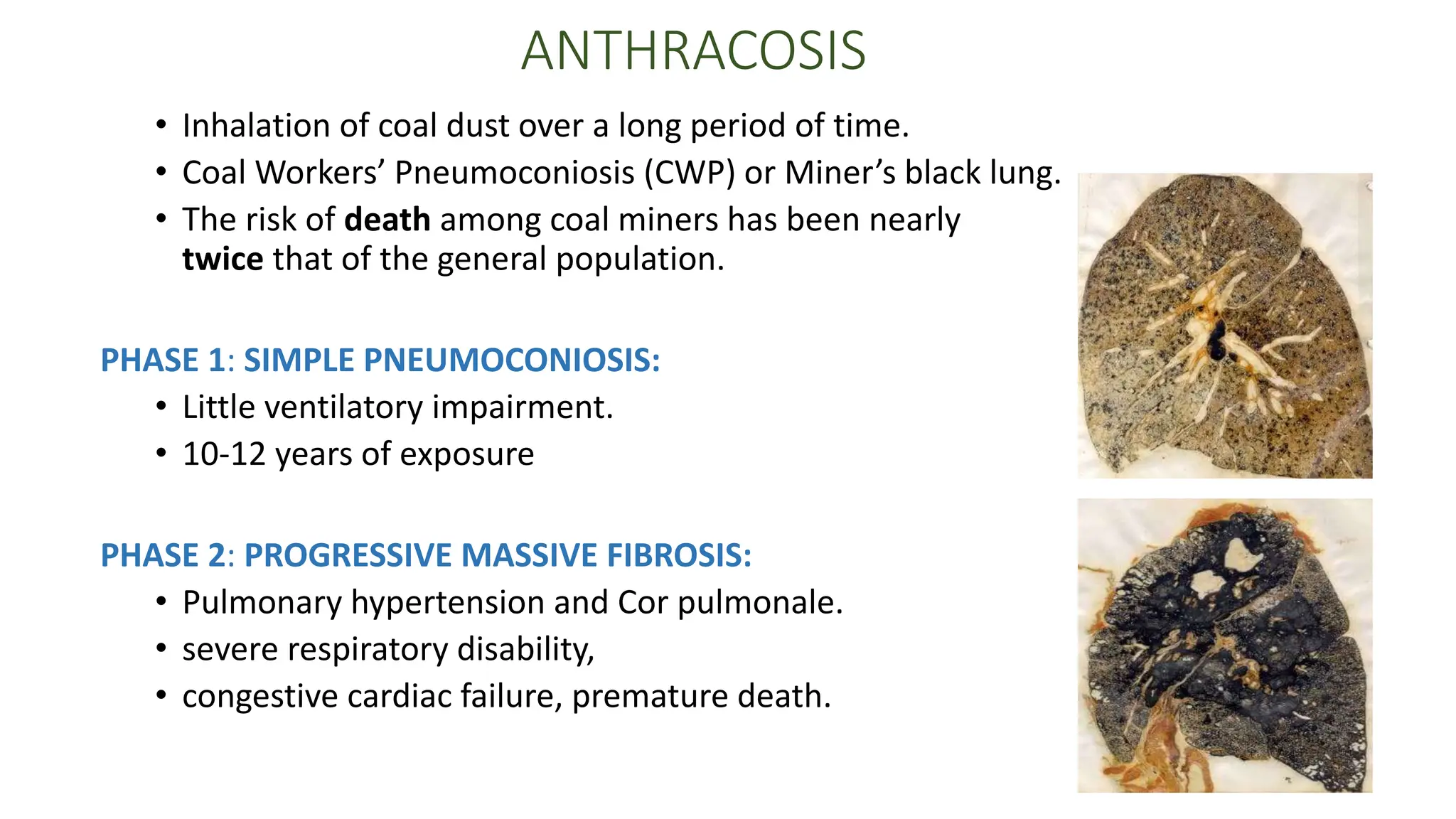 PNEUMOCONIOSIS and its preventive measures.pptx
