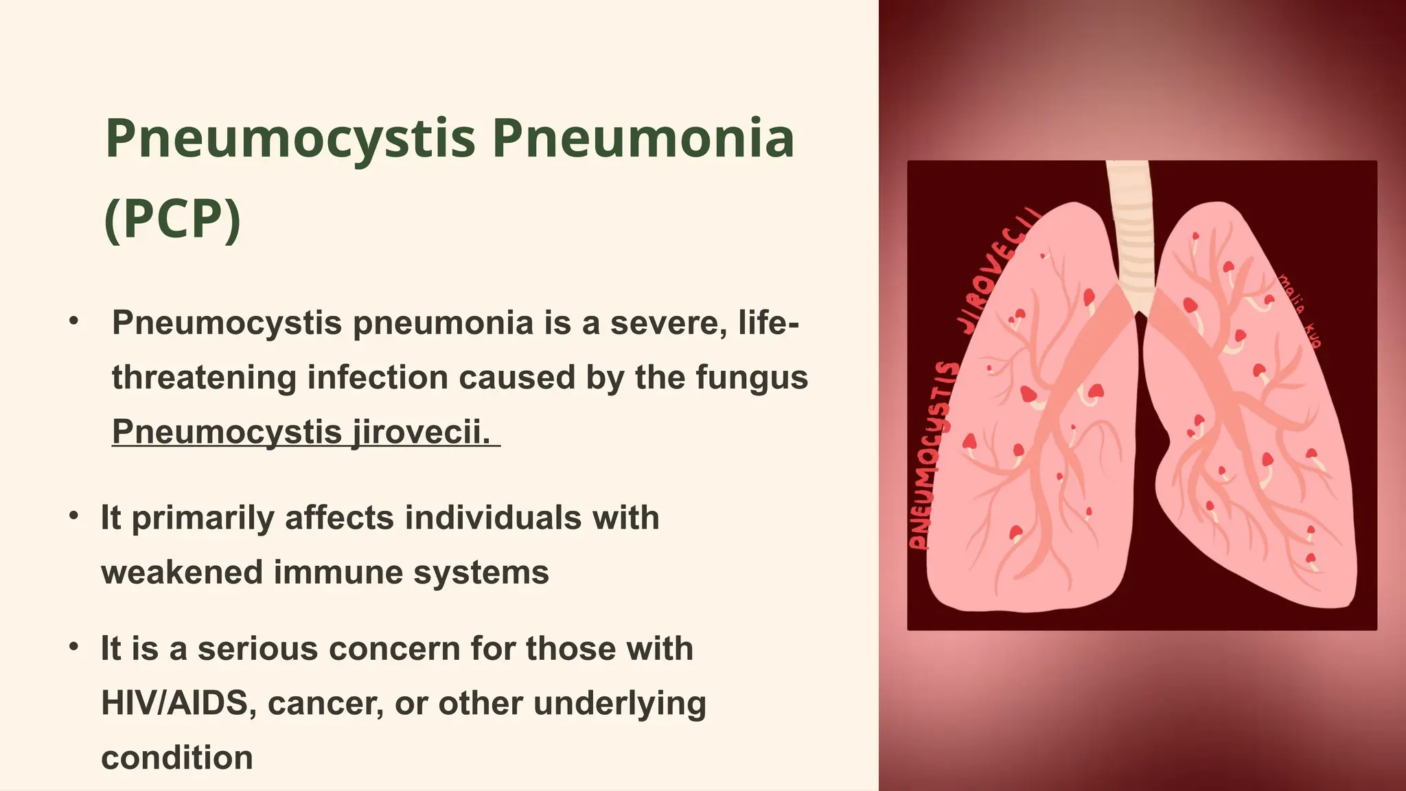 PNEUMOCYSTIS for class presentation- mbbs student | PPTX