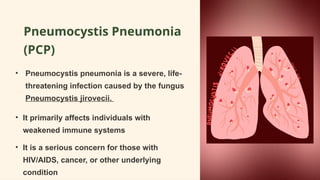 PNEUMOCYSTIS for class presentation- mbbs student | PPT