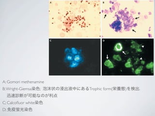 Pneumocystis carinii | PDF
