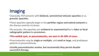 Pneumocystis Pneumonia.pptx