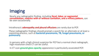 Pneumocystis Pneumonia.pptx