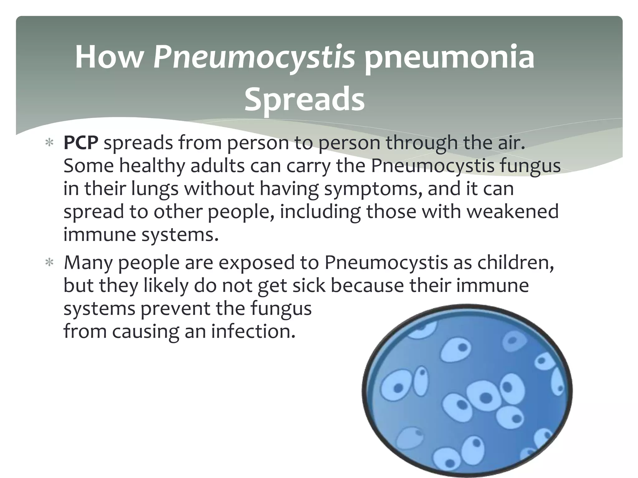 pneumocytis pneumonia.pptx (4).pptx