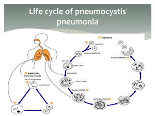 pneumocytis pneumonia.pptx (4).pptx