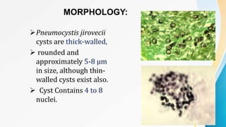 Pneumocytosis jiroveci.pptx