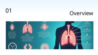 Pneumonectomy Surgery.pptx for physiotherapy students | PPTX