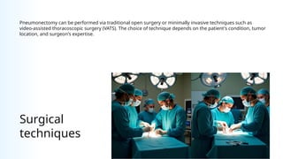 Pneumonectomy Surgery.pptx for physiotherapy students | PPTX