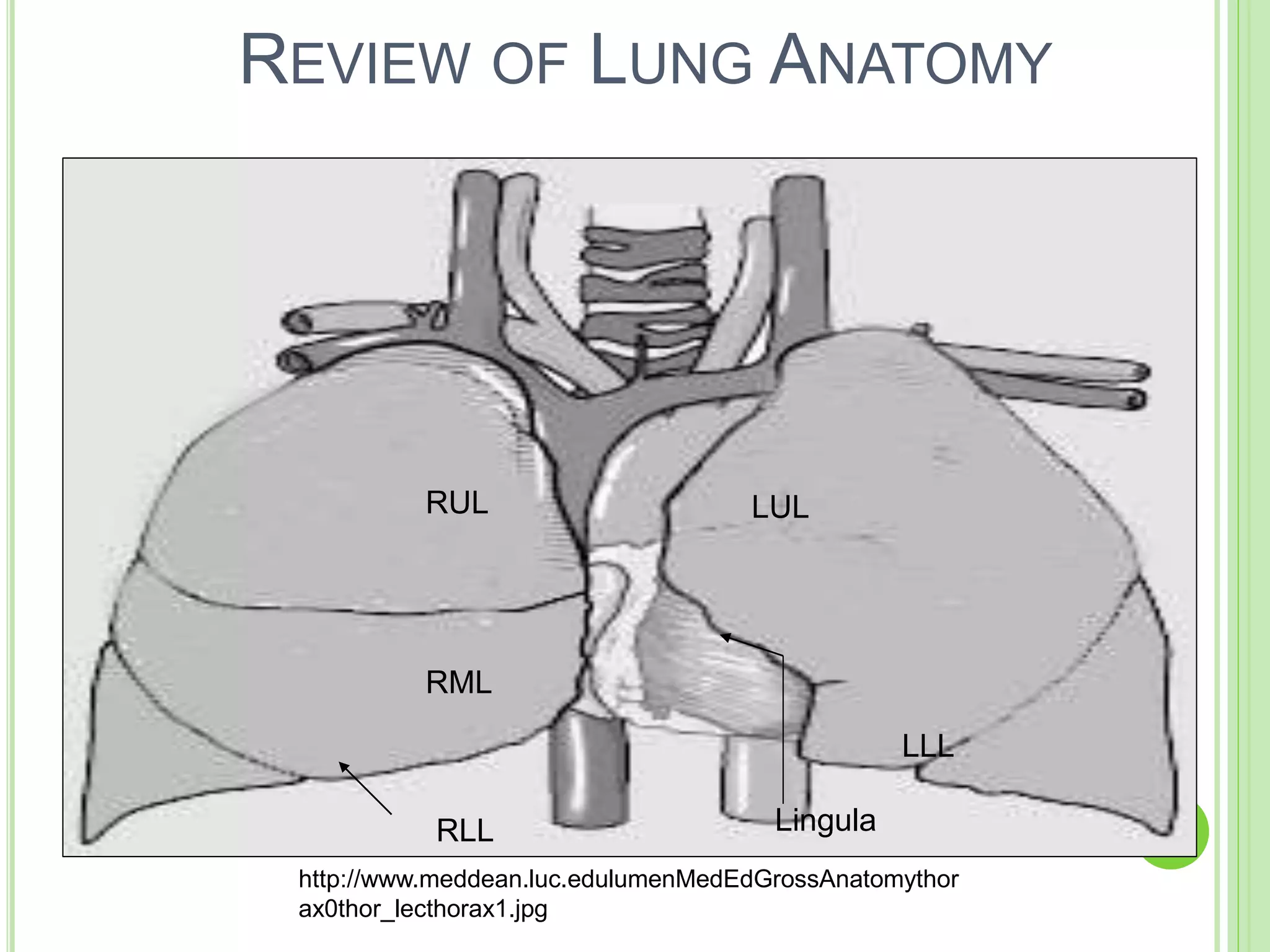 Pneumonia | PPTX