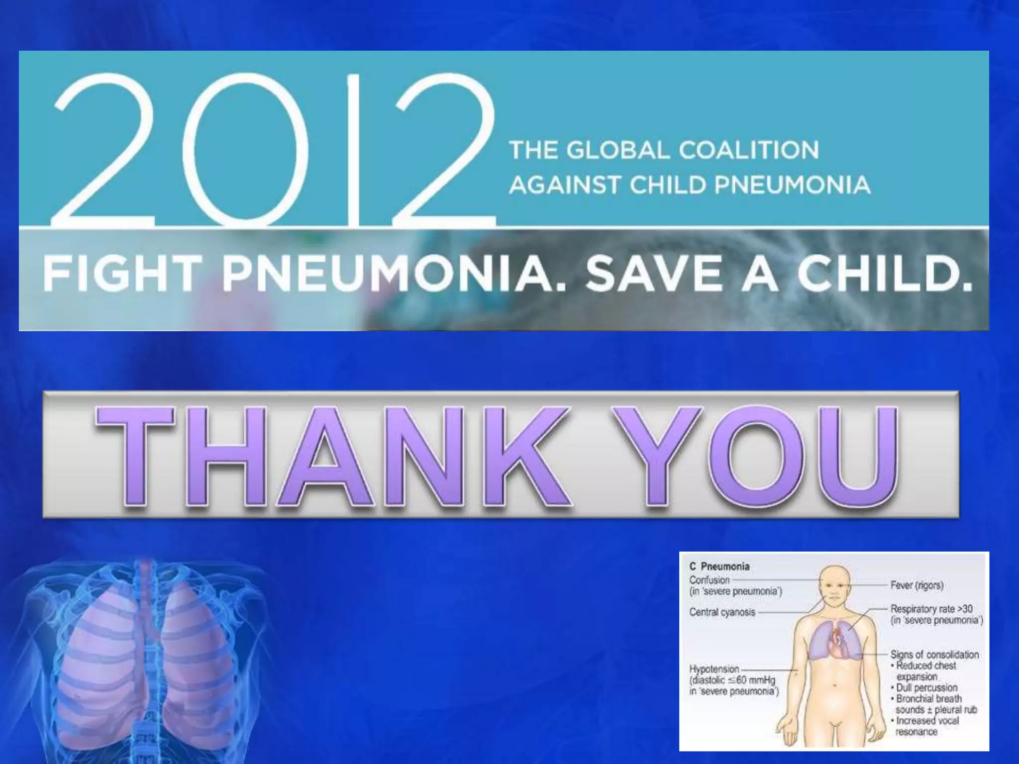 Pneumonia | PPTX