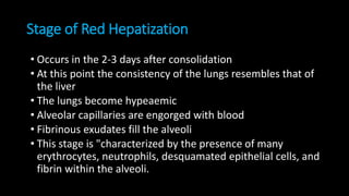 Pneumonia | PPTX | Lung and Respiratory Health | Diseases and Conditions