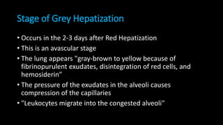 Pneumonia | PPTX | Lung and Respiratory Health | Diseases and Conditions