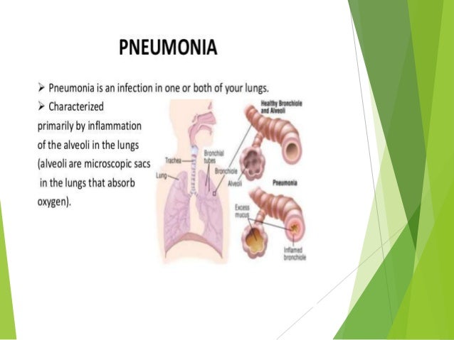 Pneumonia