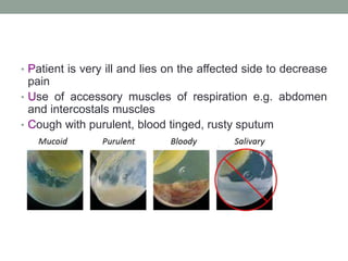Pneumonia | PPTX