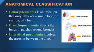 pneumonia-180227170058.pdf