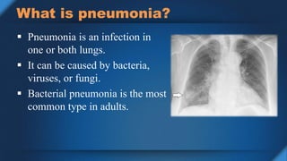 pneumonia-180227170058.pdf