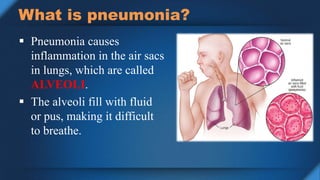 Pneumonia Slide