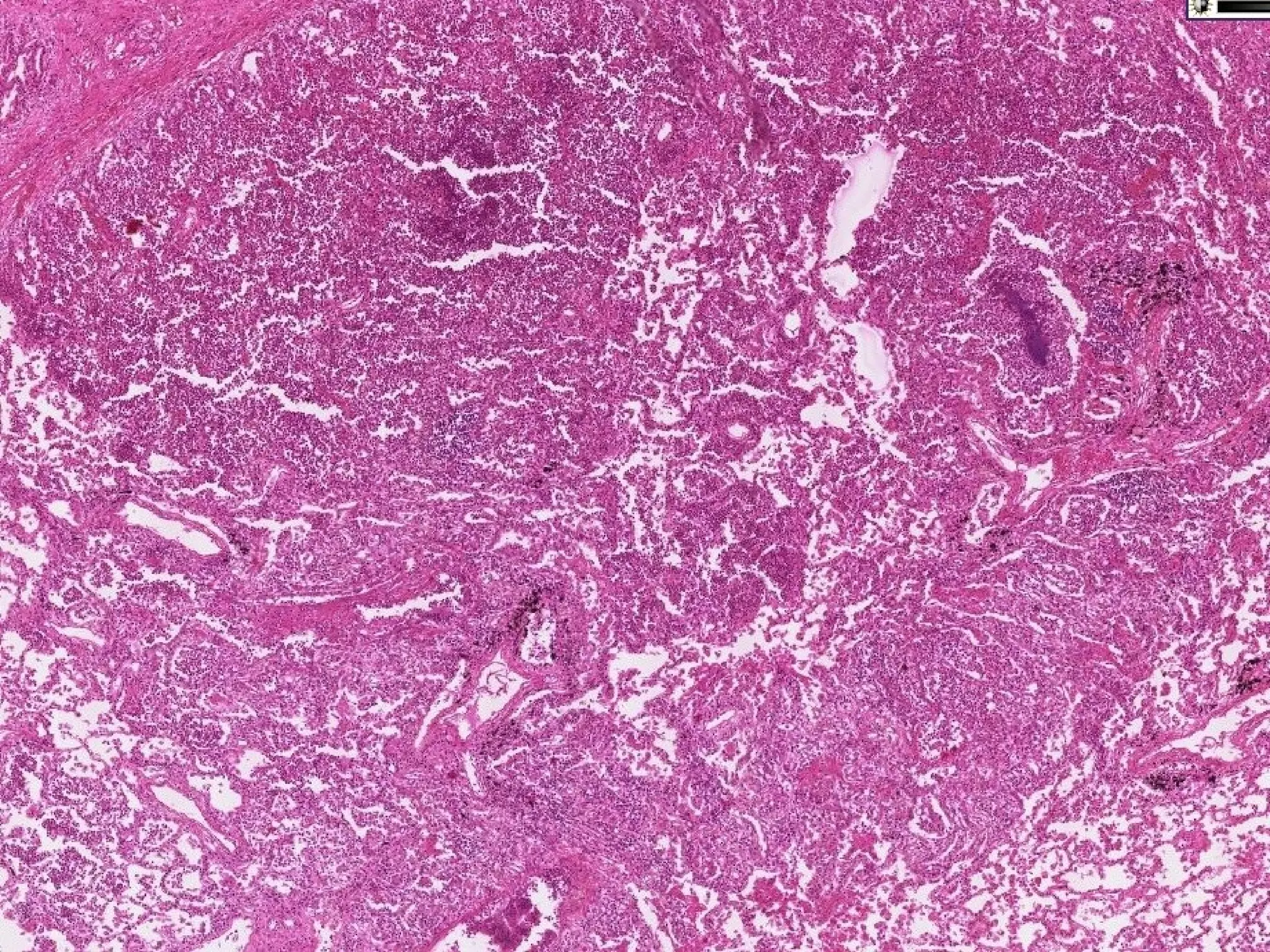Pneumonia - Classification & Etiology | PPT