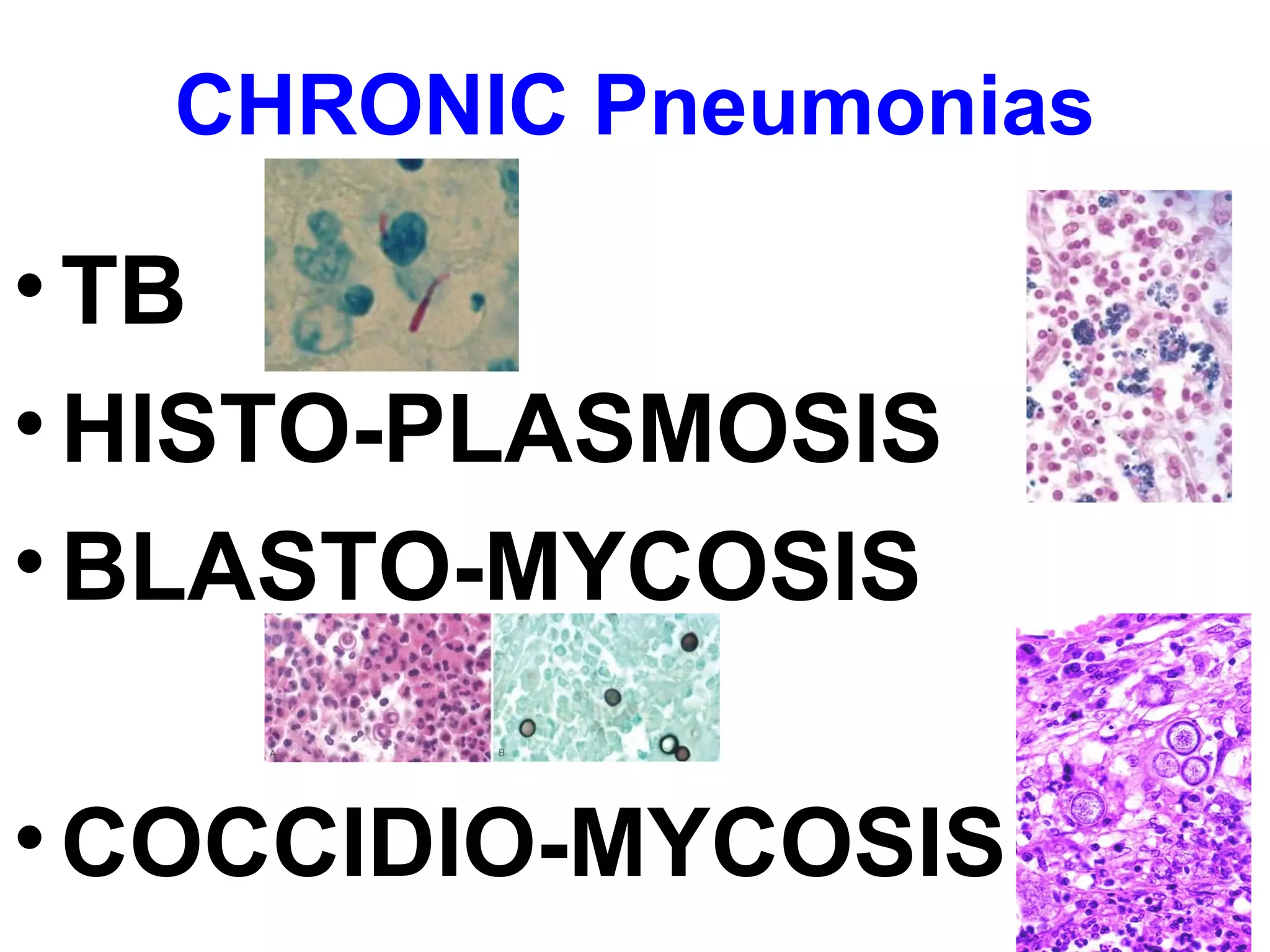 Pneumonia - Classification & Etiology | PPT