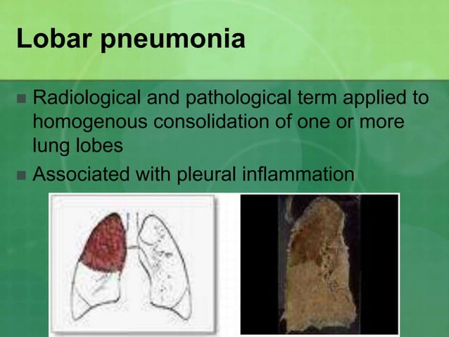 pneumonia an acute respiratory illness and it's types.pptx