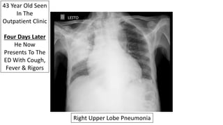 EMGuideWire's Radiology Reading Room: Pneumonia | PPTX