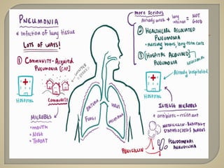 Pneumonia | PPTX