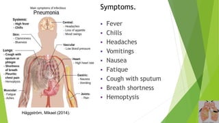 Pneumonia | PPT