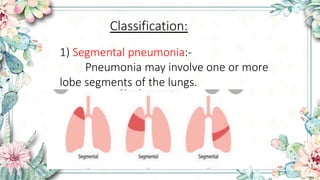 pneumonia.pptx