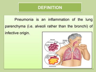 PNEUMONIA.pptx