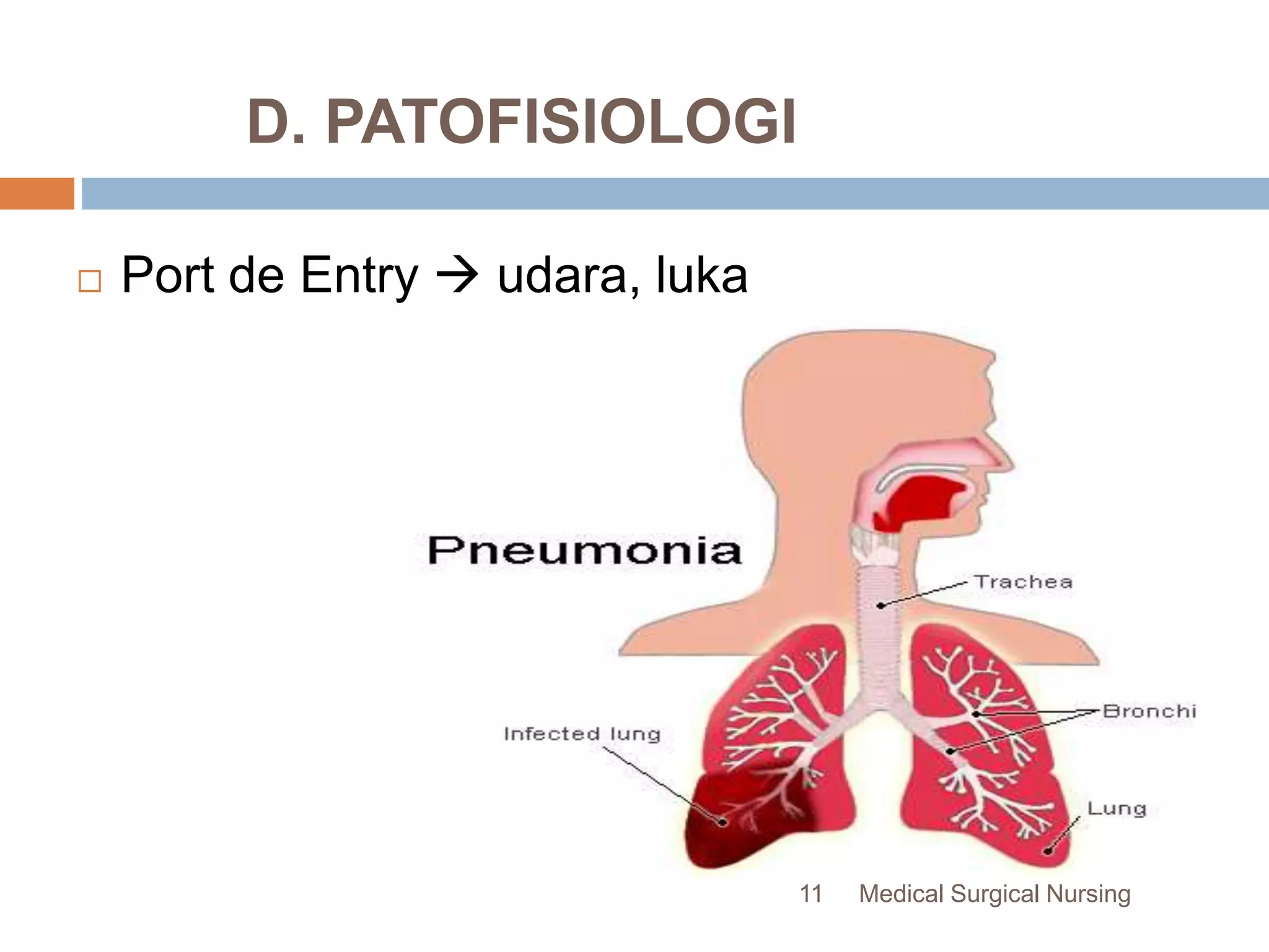 Pneumonia_.ppt